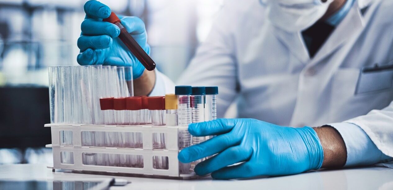 Geldards helps Bowel Cancer start-up secure £1.5m investment